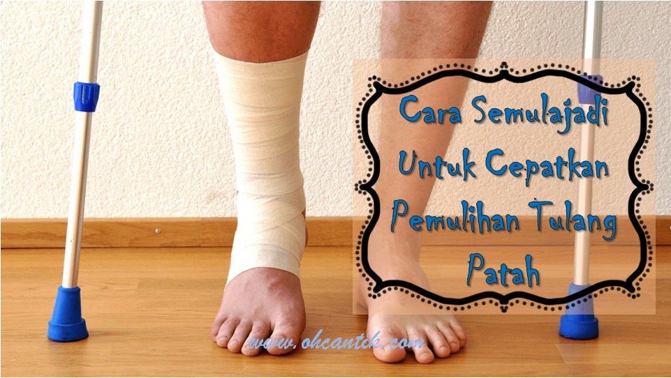 Sembuhkan Tulang Patah Cara Semulajadi | Ohcantik.com