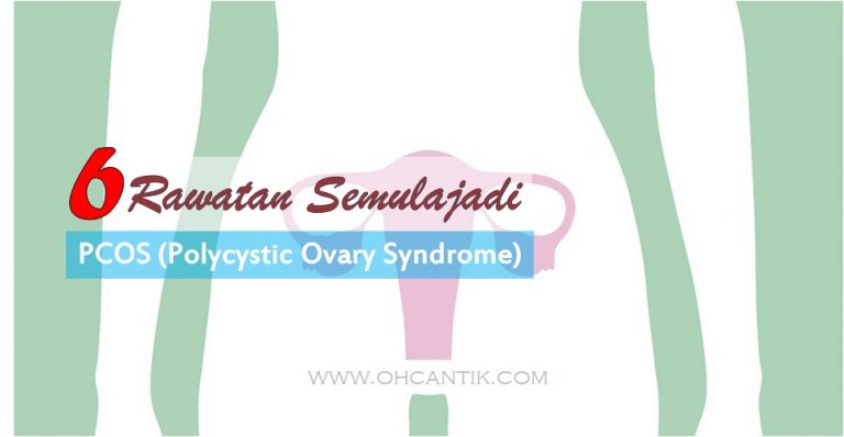 Rawatan PCOS: 6 Rawatan Semulajadi Untuk PCOS | Ohcantik.com