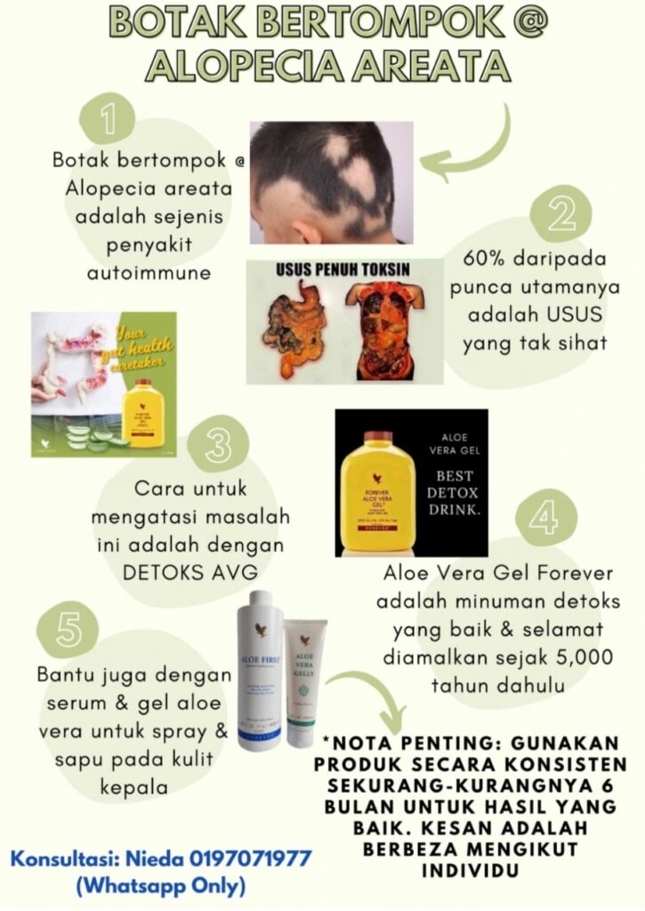 Punca Botak Bertompok & Cara Atasinya | Ohcantik.com