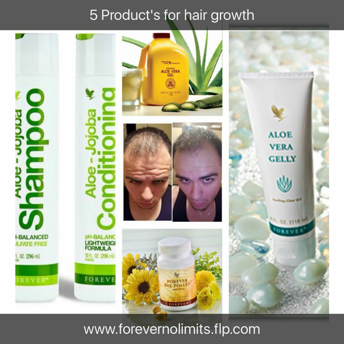 Rawatan Rambut Gugur Cara Semulajadi Berhasil! | Ohcantik.com