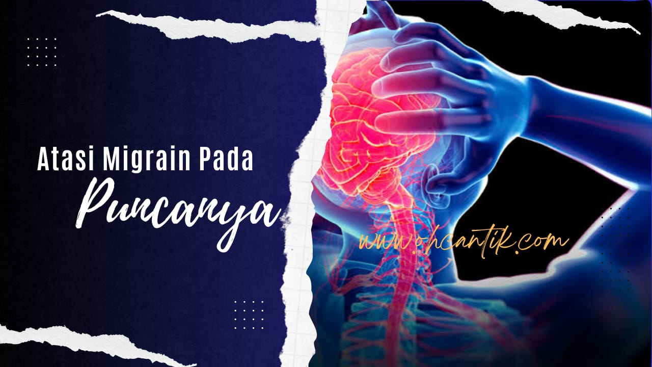 Punca Migrain Dan Cara Mengatasinya Mudah Rupanya! | Ohcantik.com